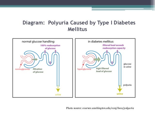 Chapter 11 presentation