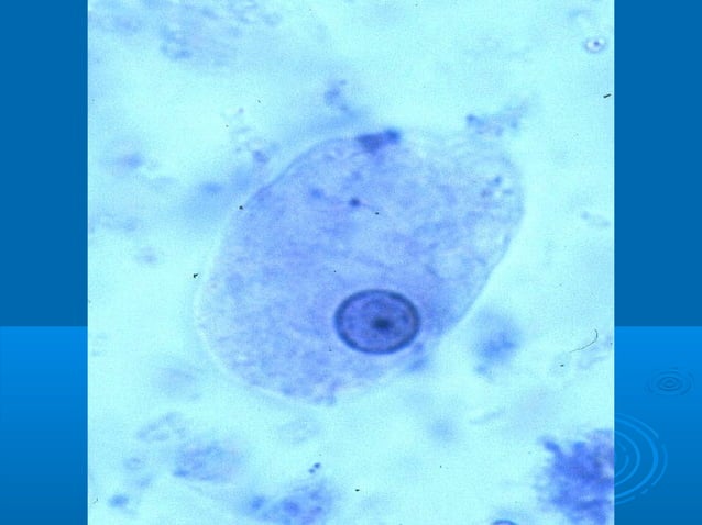 Chapter 11 protozoa | PPT