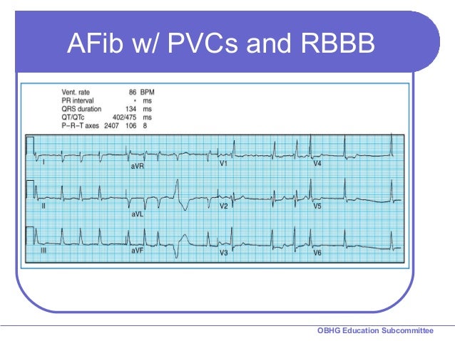 Chapter 11 - Putting It All Together