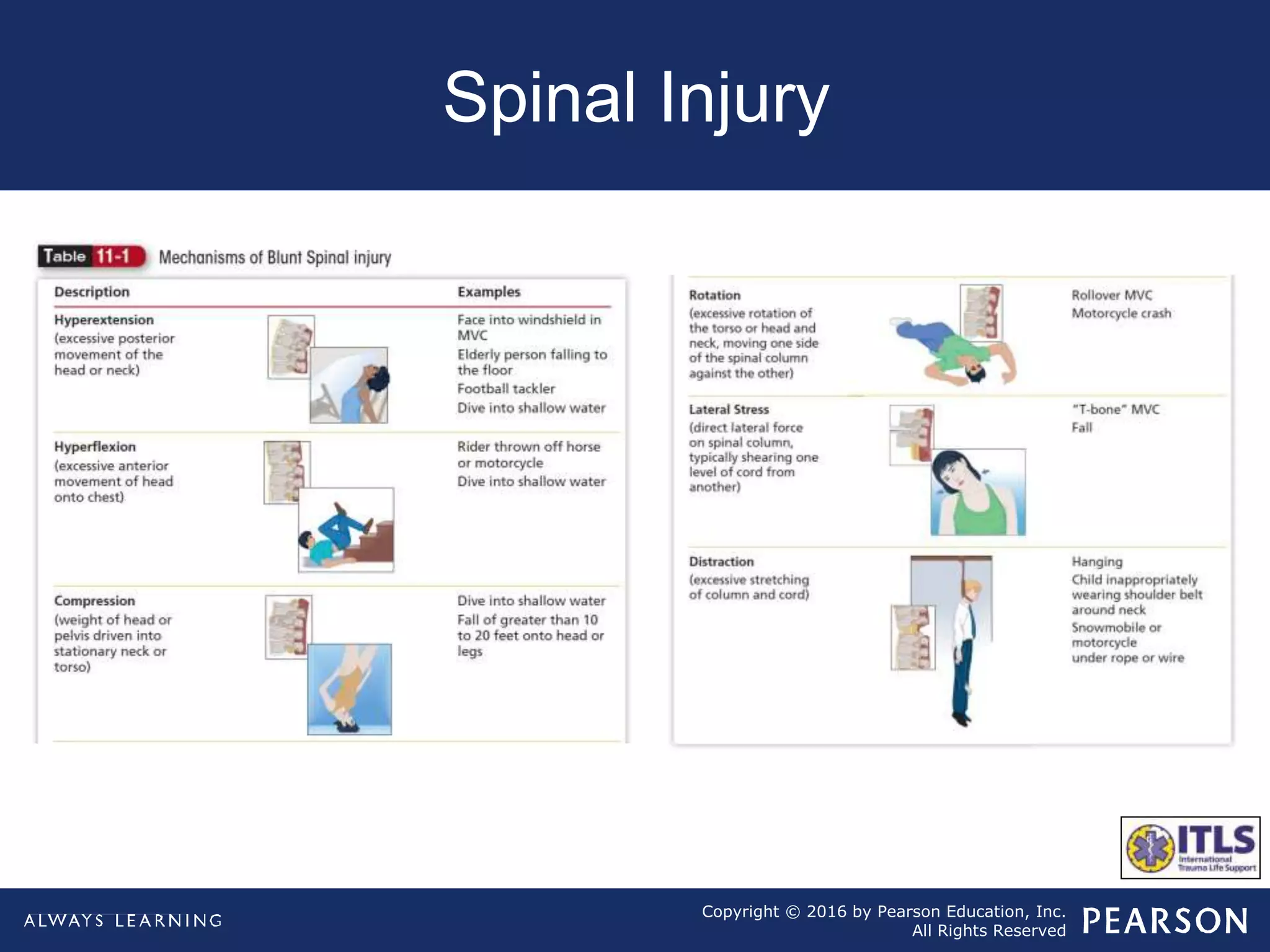 Chapter11 spinal trauma | PPT