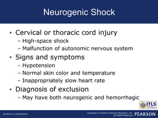 Chapter11 spinal trauma | PPT