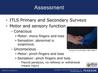 Chapter11 spinal trauma | PPT