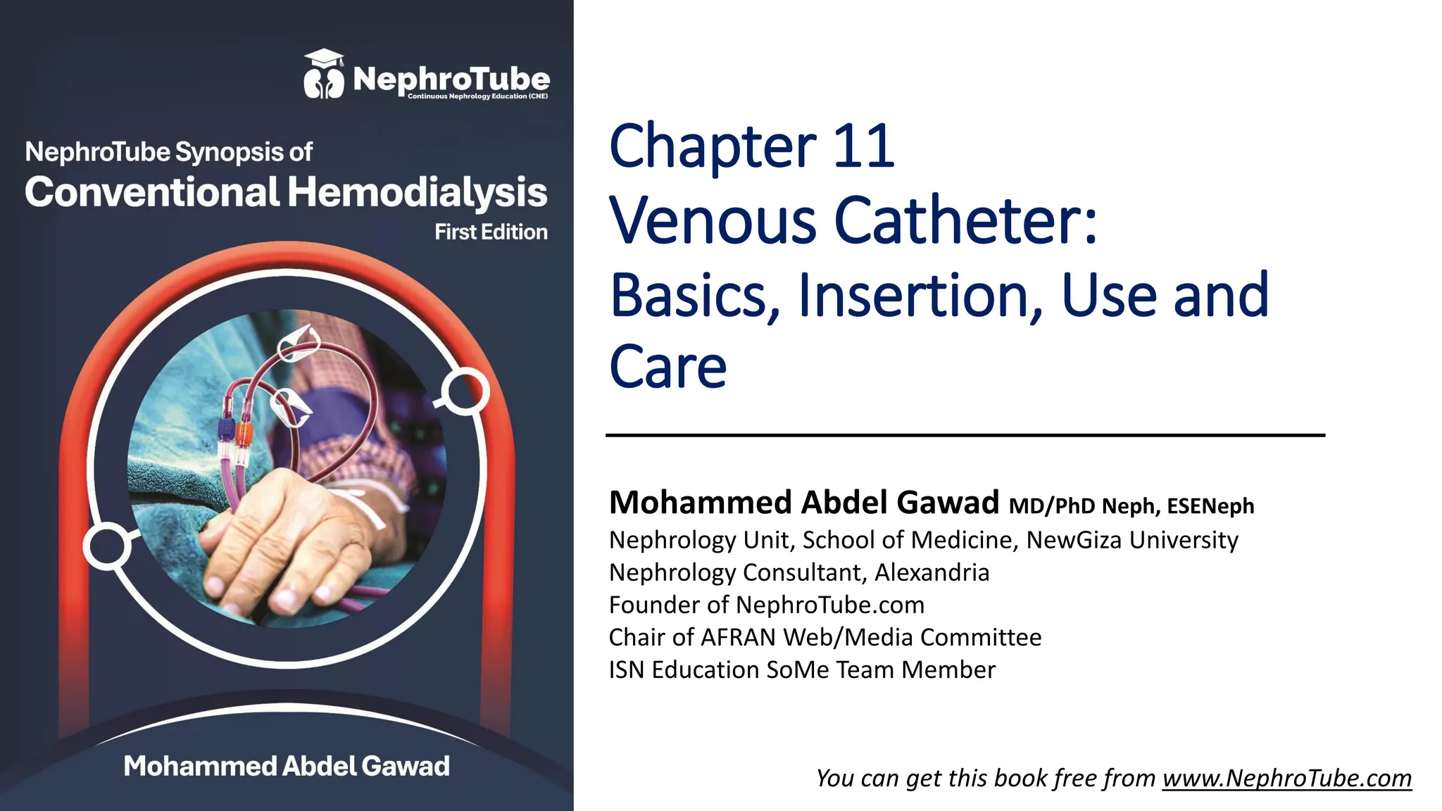 Hemodialysis: Chapter 11, Venous Catheter - Basics, Insertion, Use and ...