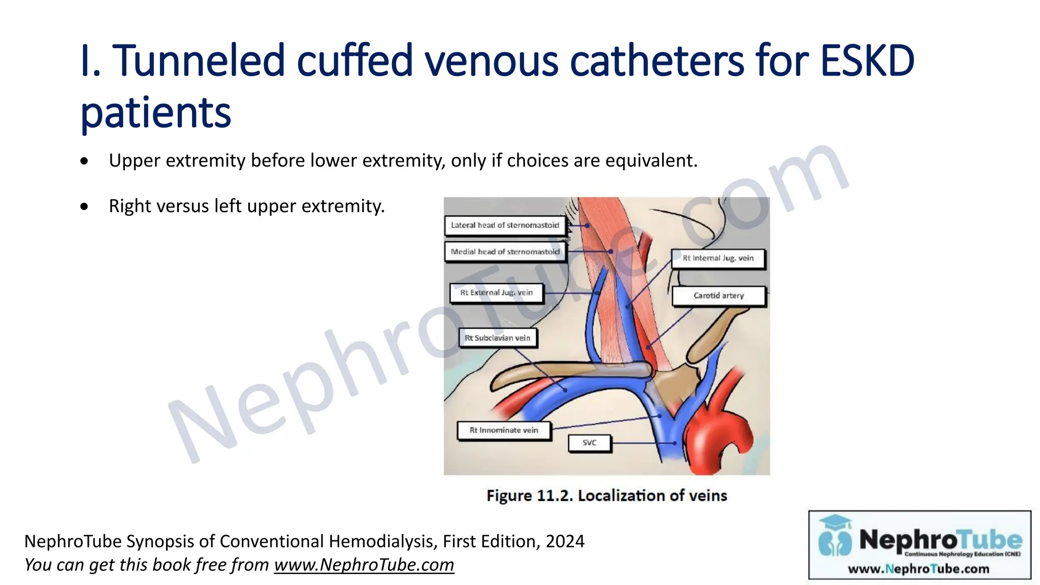 Hemodialysis: Chapter 11, Venous Catheter - Basics, Insertion, Use and ...