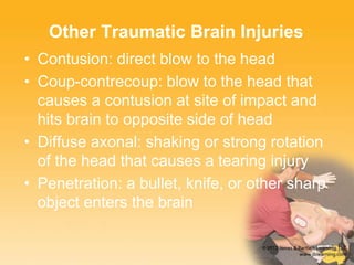 Chapter 12 Head and Spinal Injuries | PPTX