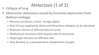 Chapter 12 respiratory-mod (1) | PPT