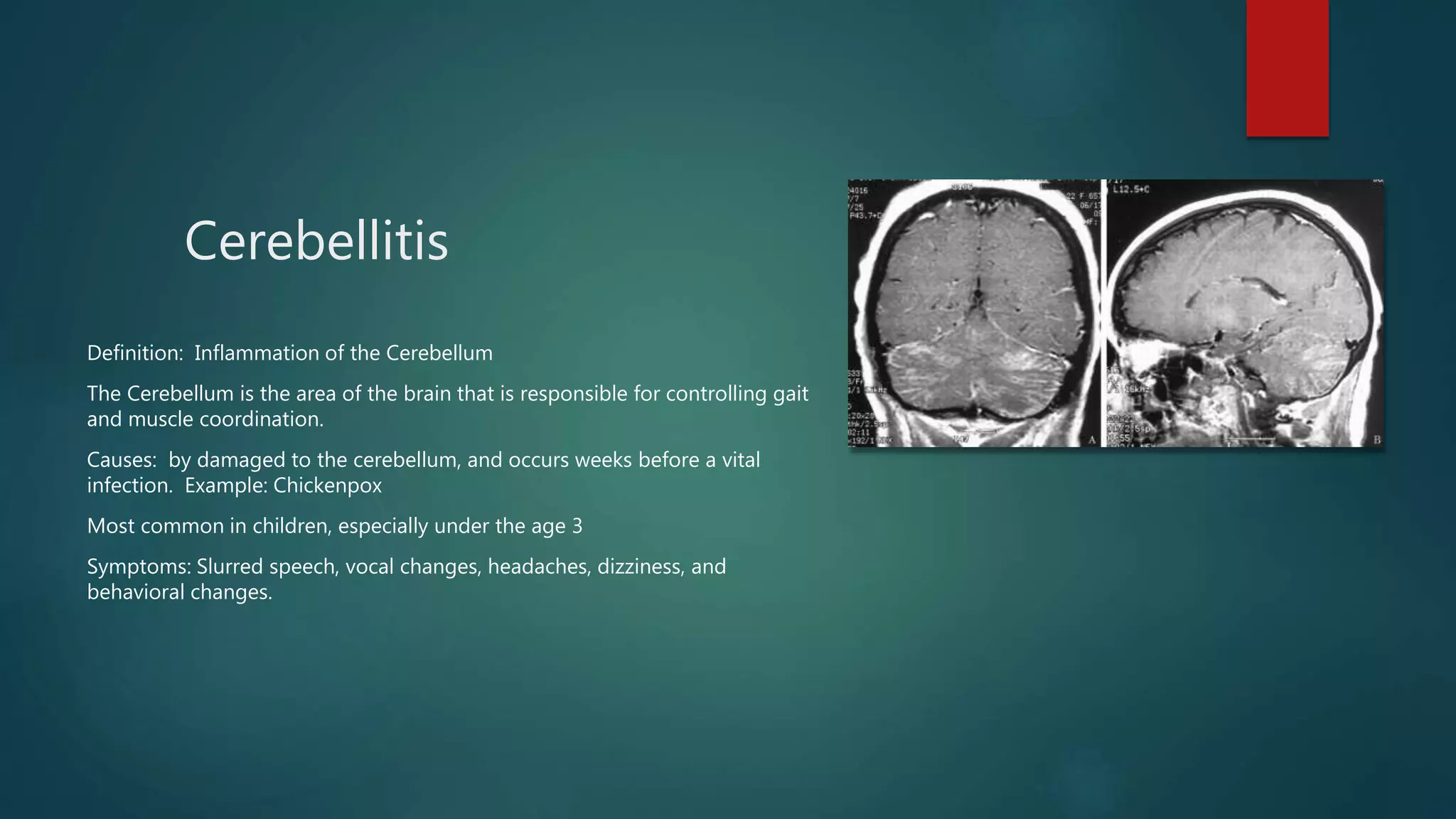 Chapter 12 Nervous System | PPT