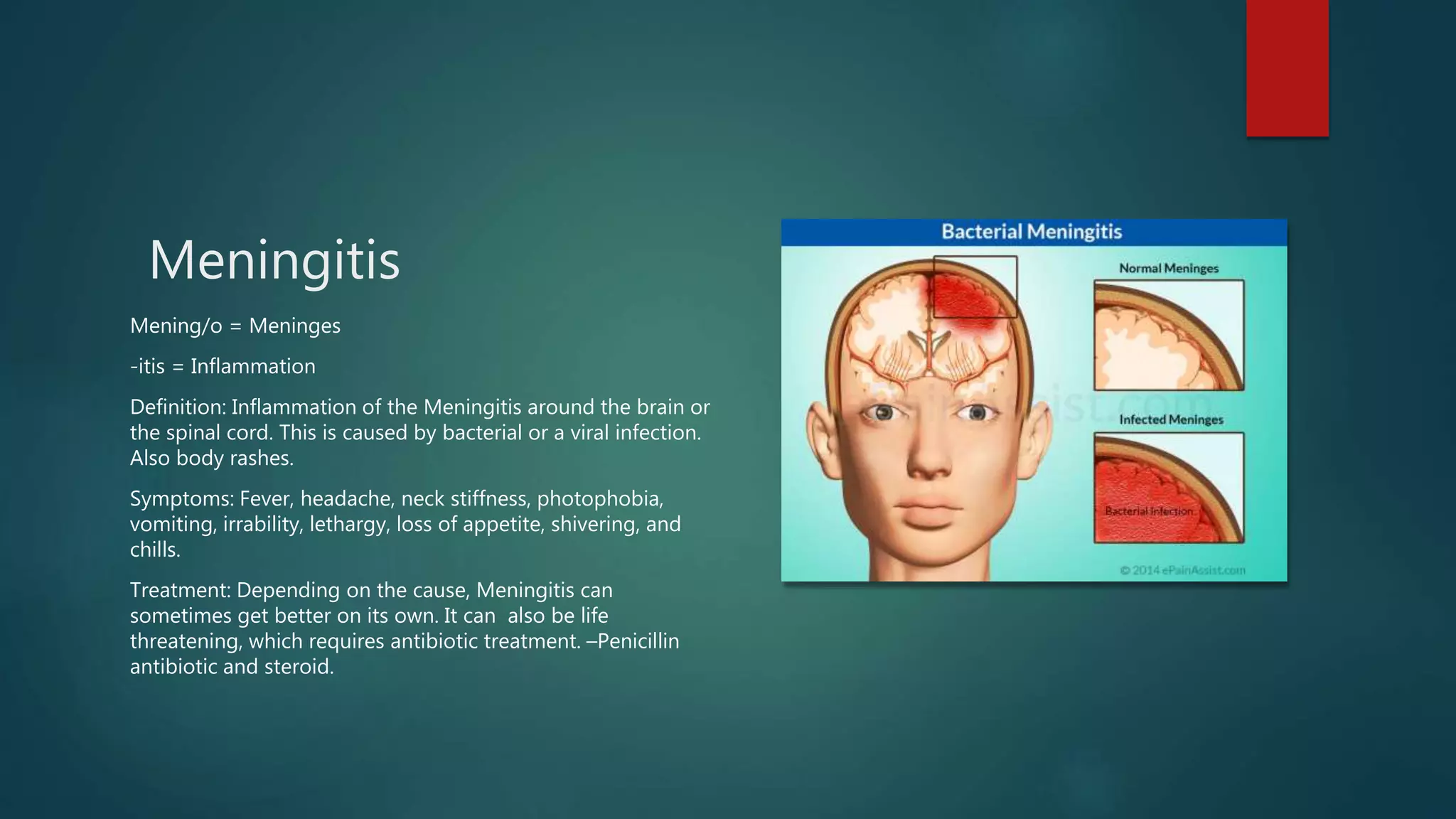 Chapter 12 Nervous System | PPT