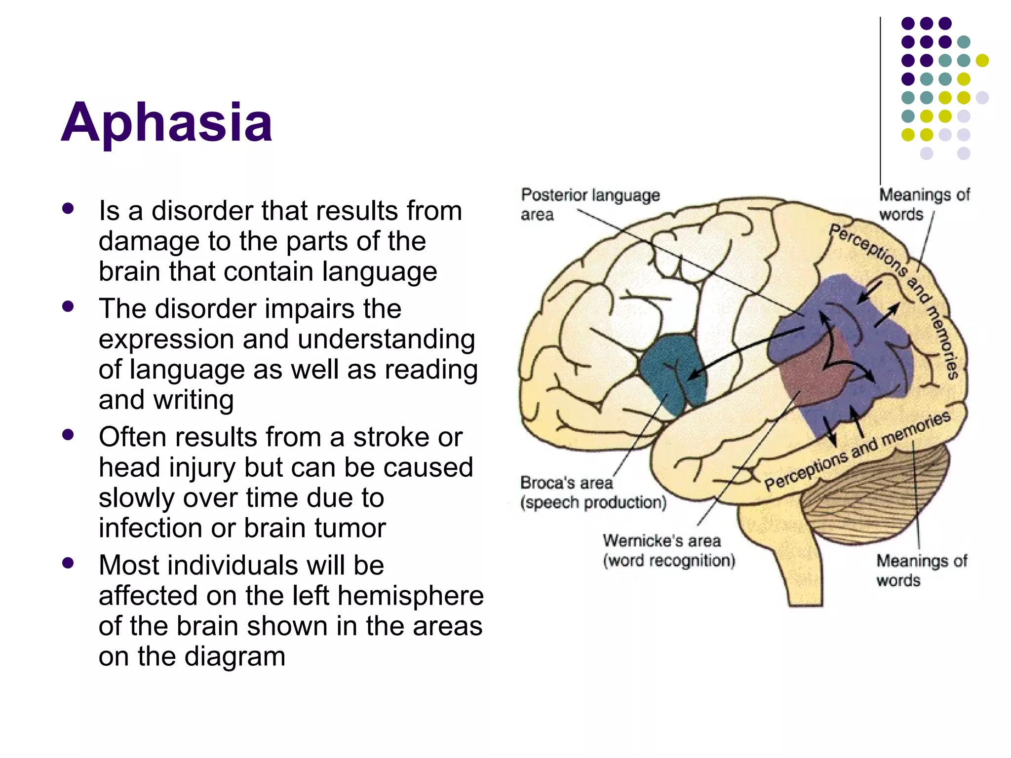 Chapter 12 nervous system | PPT