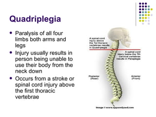 Chapter 12 nervous system | PPT