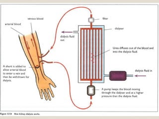 Chapter 13.1- EXCRETION IN HUMANS IGCSE BIO | PPTX