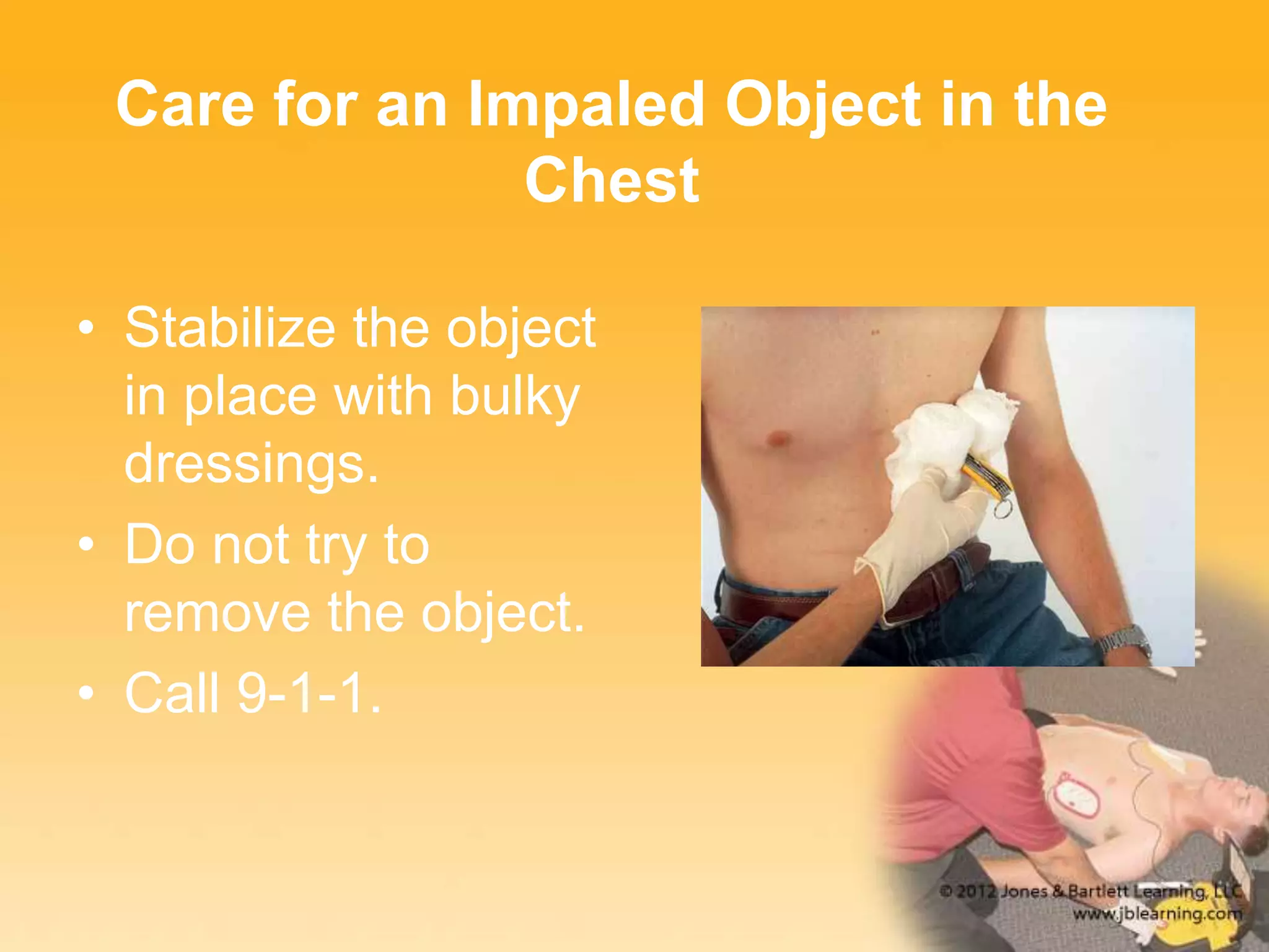 Chapter 13 Chest, Abdominal, and Pelvic Injuries | PPTX