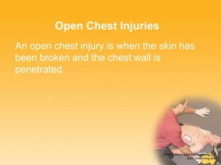 Chapter 13 Chest, Abdominal, and Pelvic Injuries | PPTX