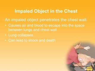 Chapter 13 Chest, Abdominal, and Pelvic Injuries | PPTX