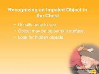 Chapter 13 Chest, Abdominal, and Pelvic Injuries | PPTX