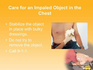 Chapter 13 Chest, Abdominal, and Pelvic Injuries | PPTX