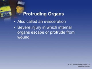 Chapter 13 Chest, Abdominal, and Pelvic Injuries | PPTX