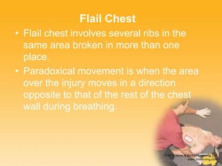 Chapter 13 Chest, Abdominal, and Pelvic Injuries | PPTX