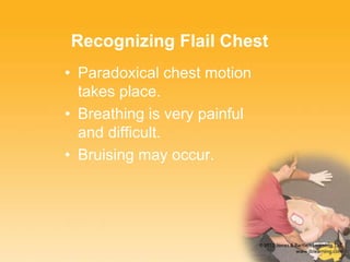 Chapter 13 Chest, Abdominal, and Pelvic Injuries | PPTX