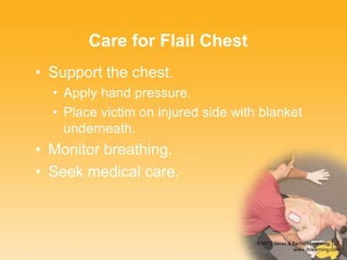 Chapter 13 Chest, Abdominal, and Pelvic Injuries | PPTX