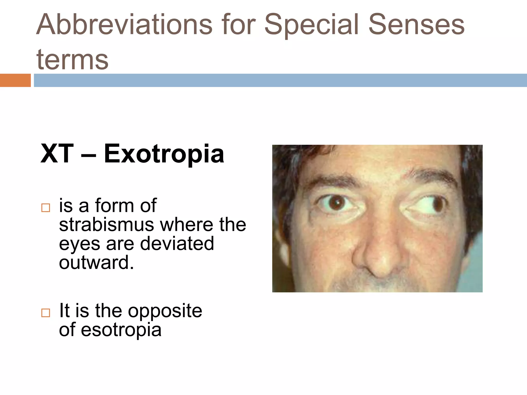 Chapter 13 special senses | PPTX