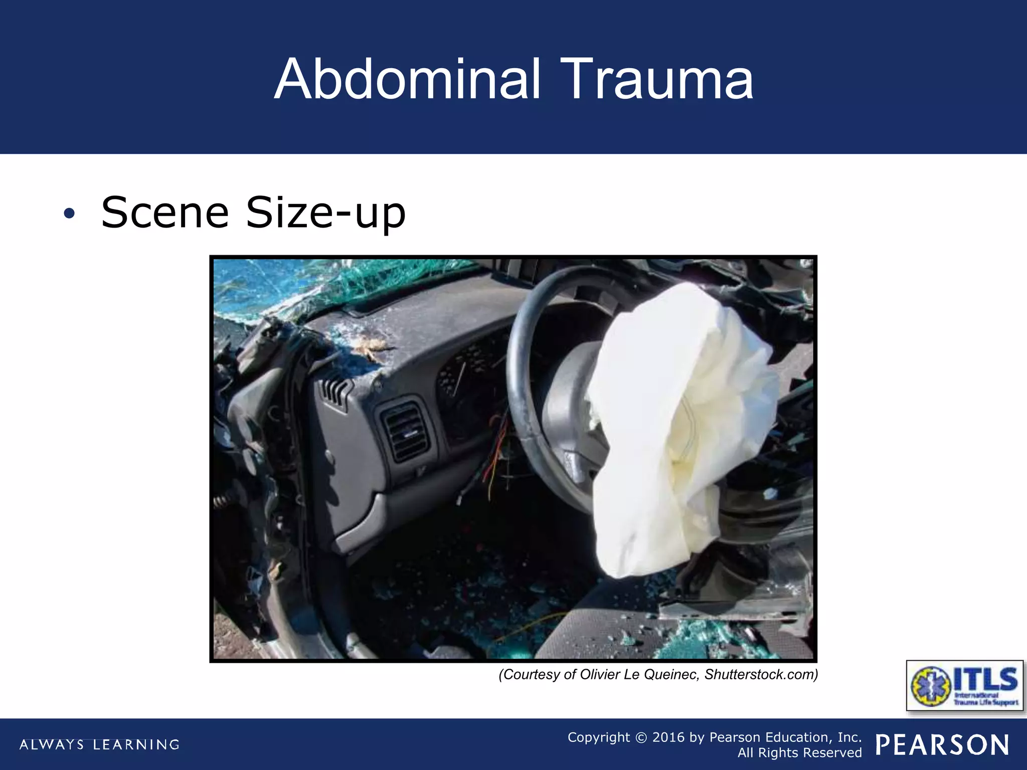 Chapter13 abdominal trauma | PPT