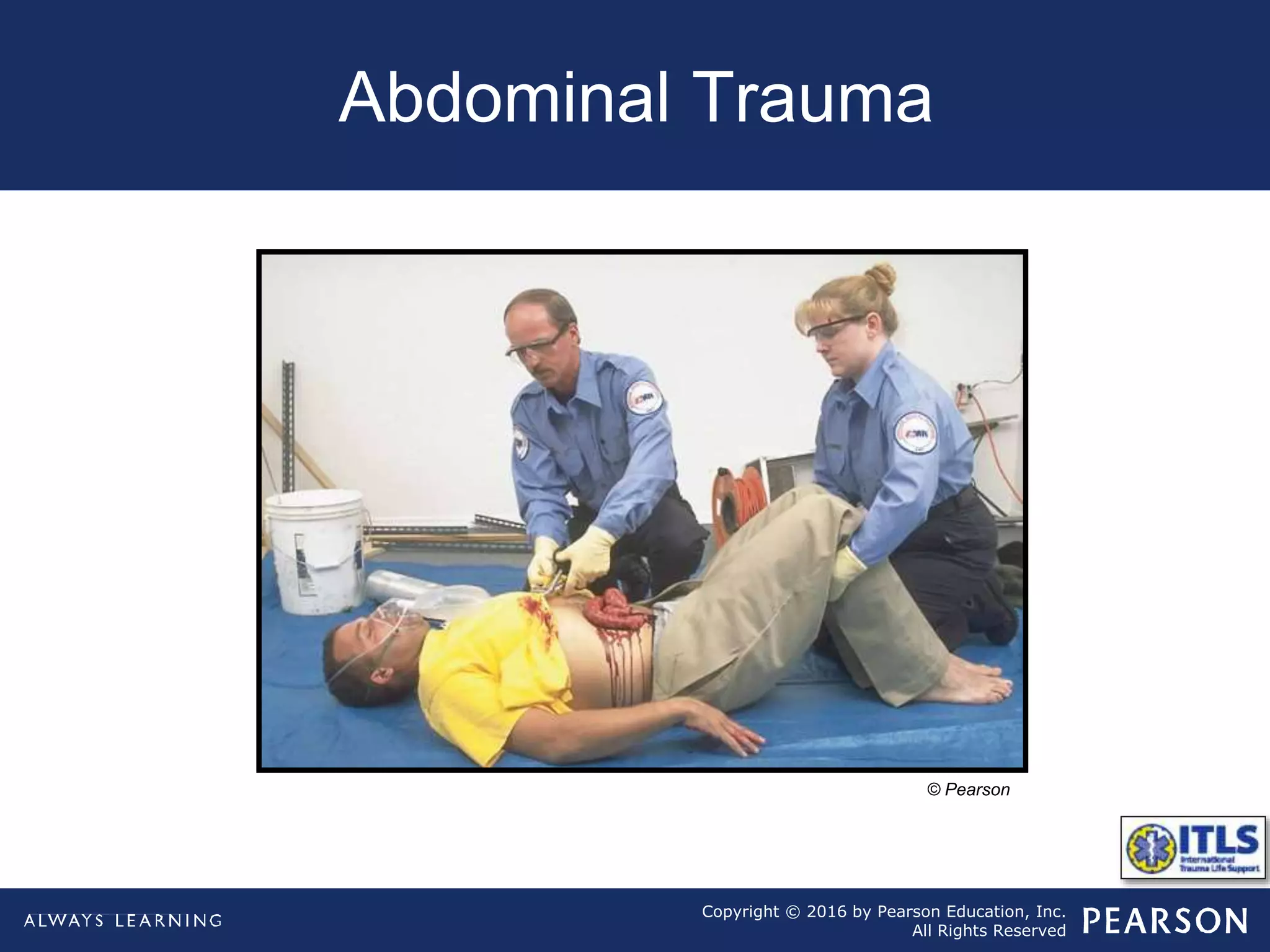 Chapter13 abdominal trauma | PPT