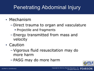 Chapter13 abdominal trauma | PPT