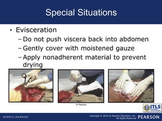 Chapter13 abdominal trauma | PPT