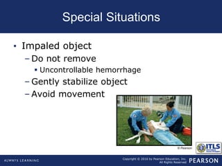 Chapter13 abdominal trauma | PPT