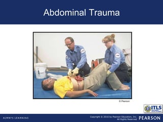 Chapter13 abdominal trauma | PPT