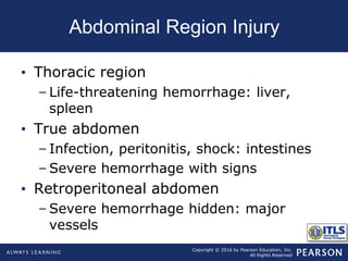 Chapter13 abdominal trauma | PPT