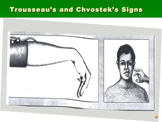 Chapter 13 And 15 Electrolyte Imbalance Part 4 | PPT | Endocrine and ...