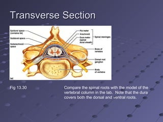 Chapter13 cns part2marieb | PPT