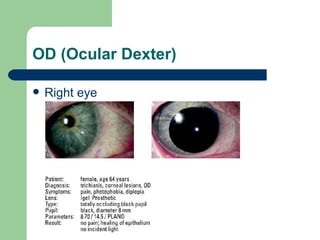 Chapter 13 eye and ear abbreviation | PPT