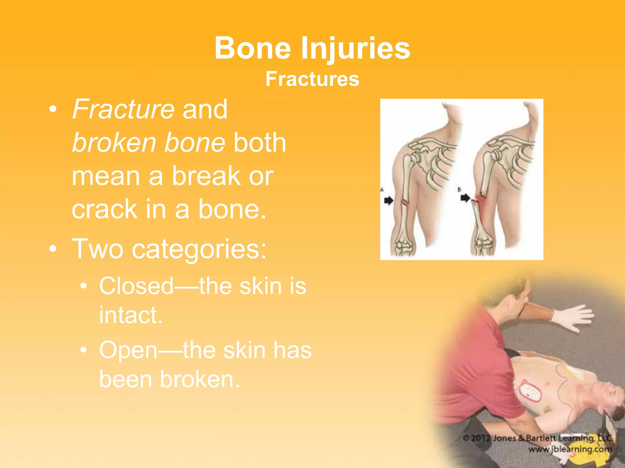 Chapter 14 Bone, Joint, and Muscle Injuries | PPTX