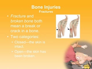 Chapter 14 Bone, Joint, and Muscle Injuries | PPTX