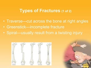 Chapter 14 Bone, Joint, and Muscle Injuries | PPTX