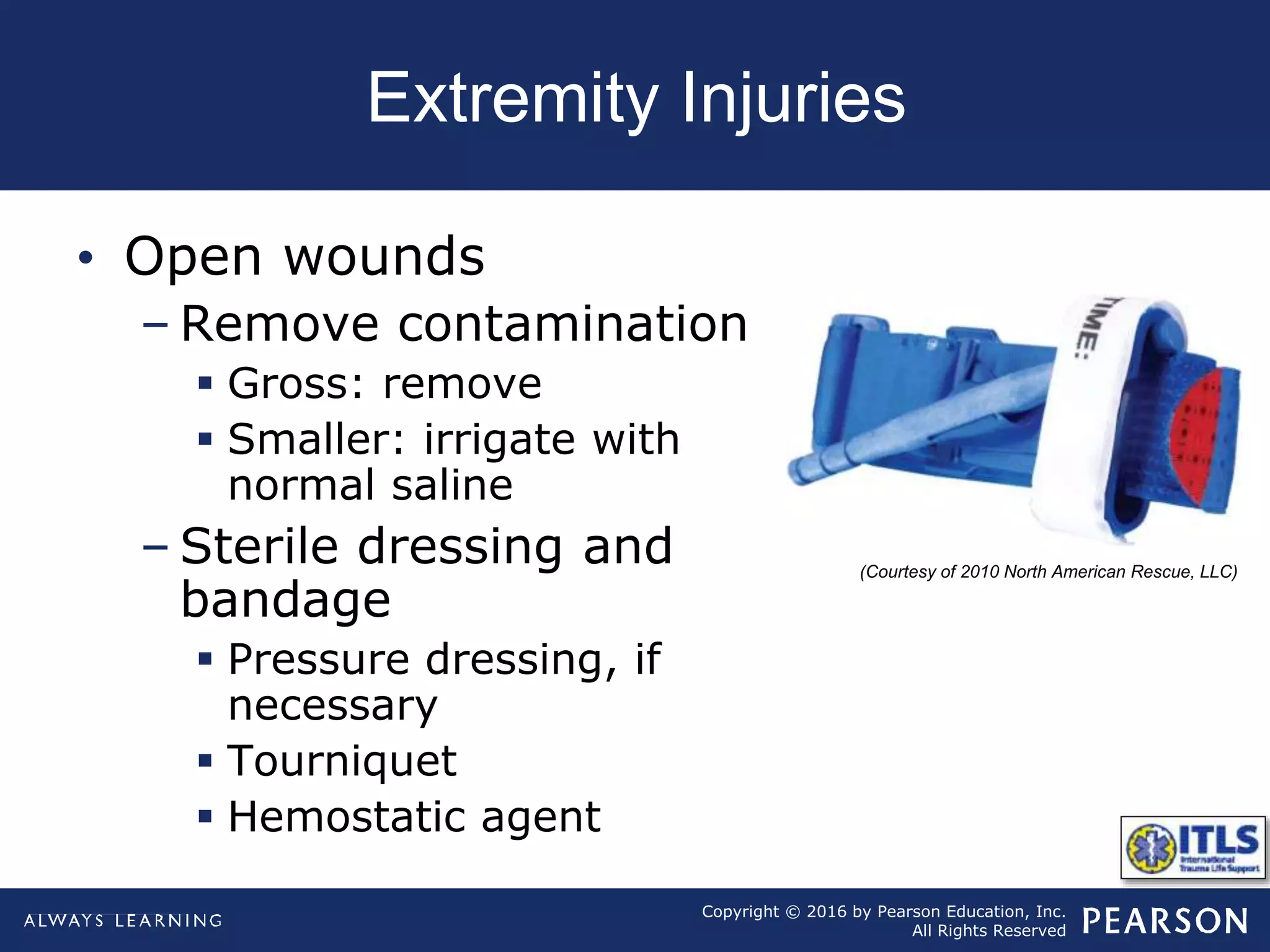 Chapter14 extremity trauma | PPT