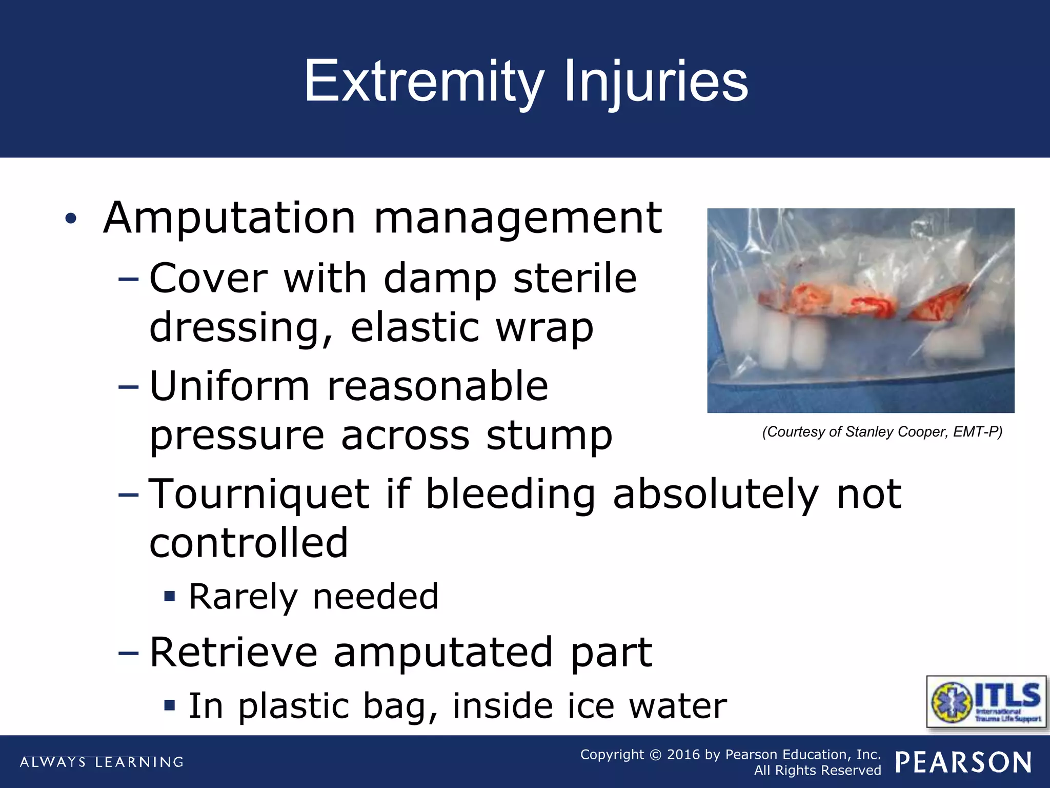 Chapter14 extremity trauma | PPT