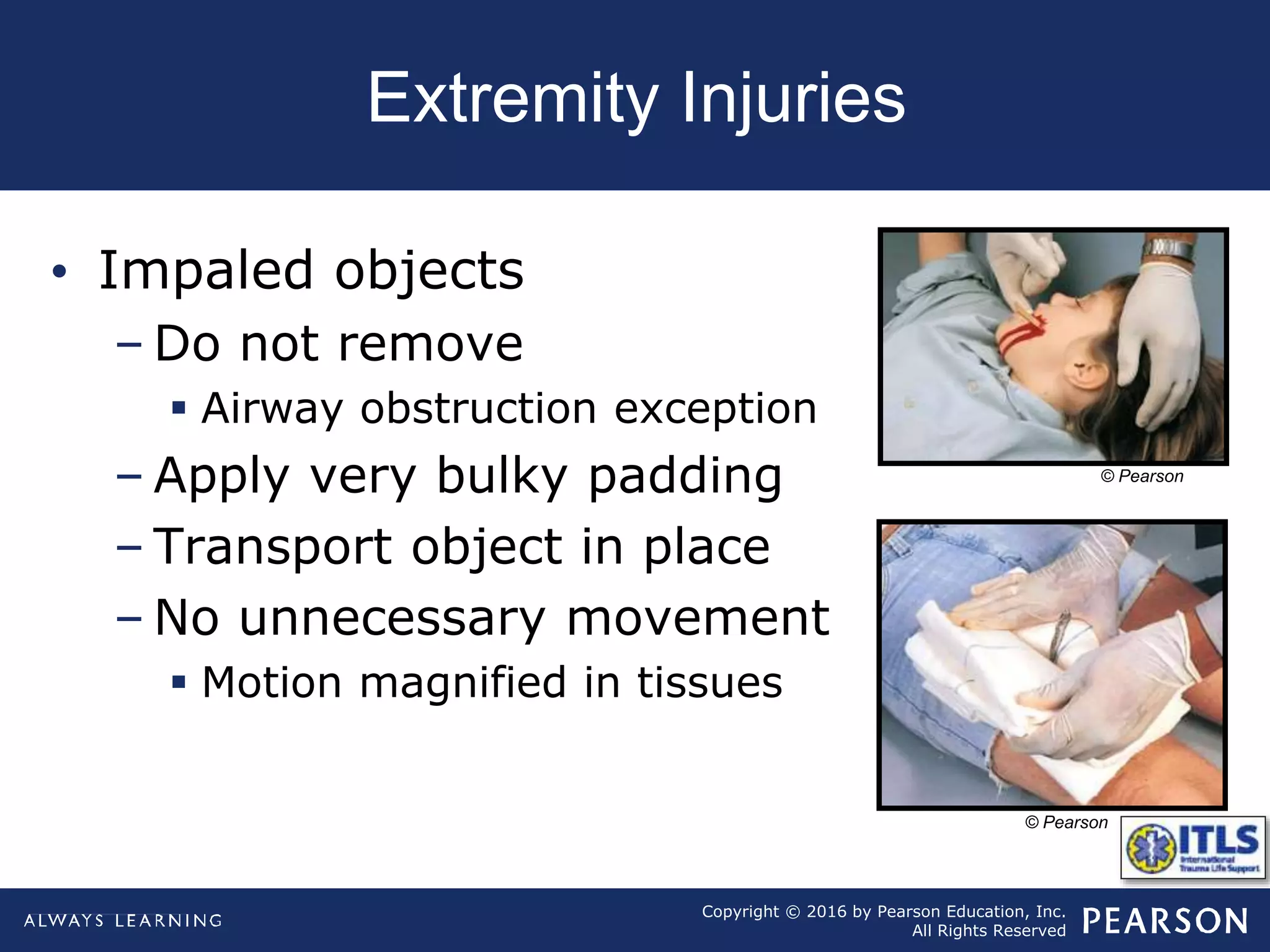 Chapter14 extremity trauma | PPT