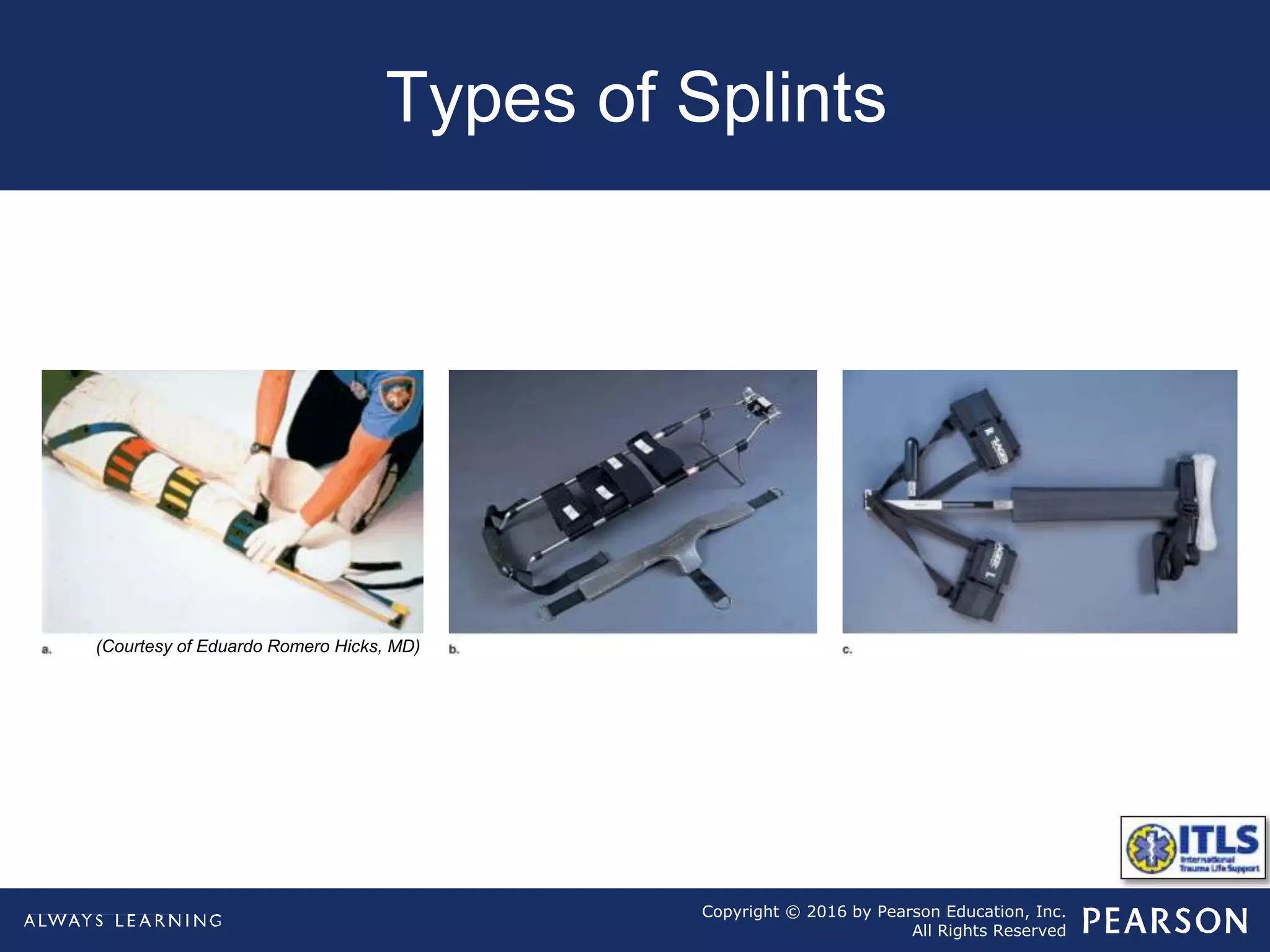 Chapter14 extremity trauma | PPT