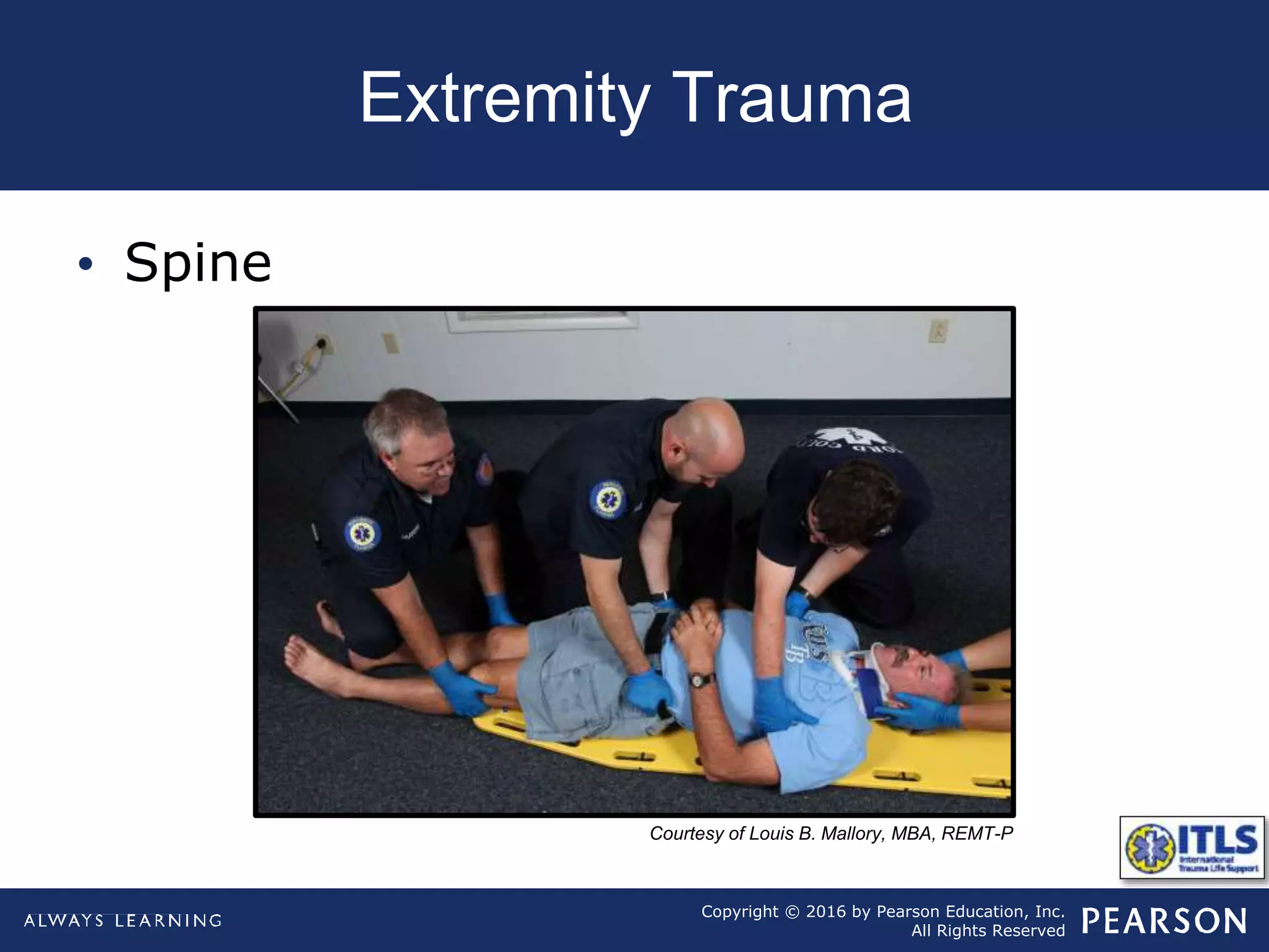 Chapter14 extremity trauma | PPT