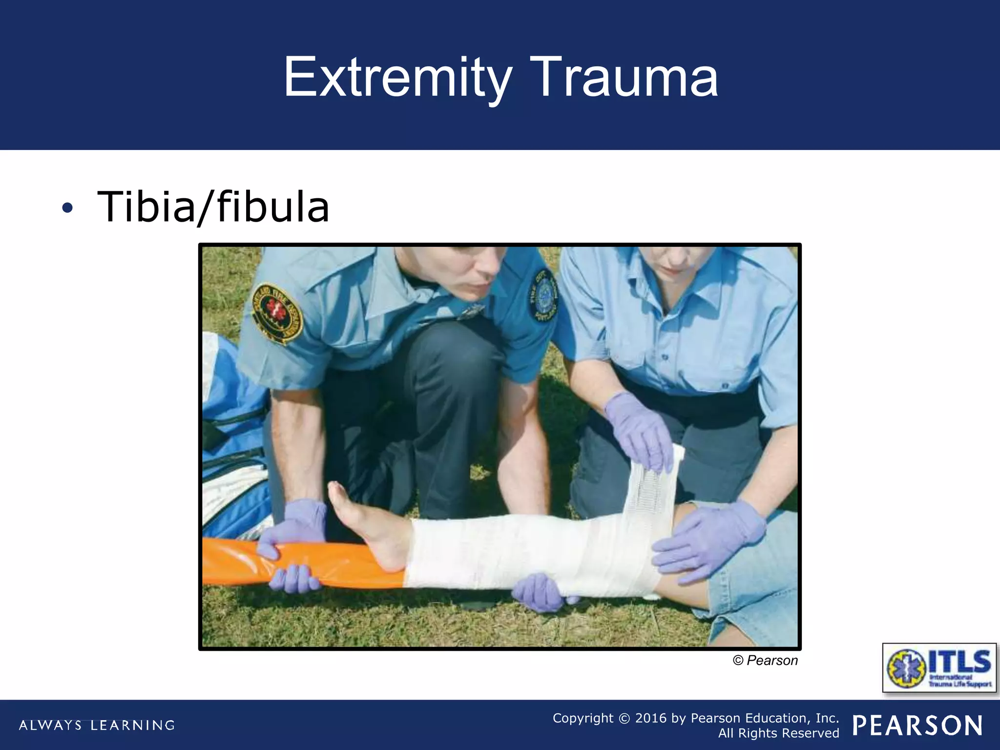 Chapter14 extremity trauma | PPT