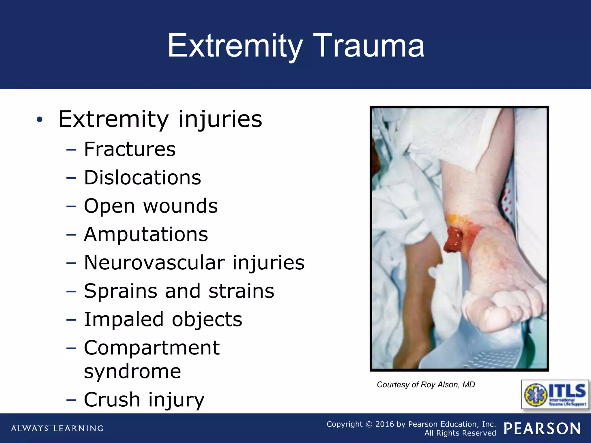 Chapter14 extremity trauma | PPT