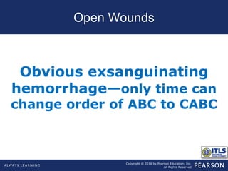 Chapter14 extremity trauma | PPT