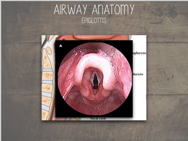 Chapter 15 airway | PDF