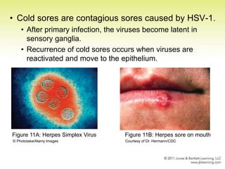Viral Infections of the Respiratory Tract and Skin | PPT