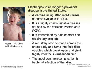 Viral Infections of the Respiratory Tract and Skin | PPT