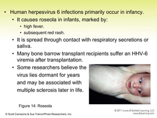 Viral Infections of the Respiratory Tract and Skin | PPT